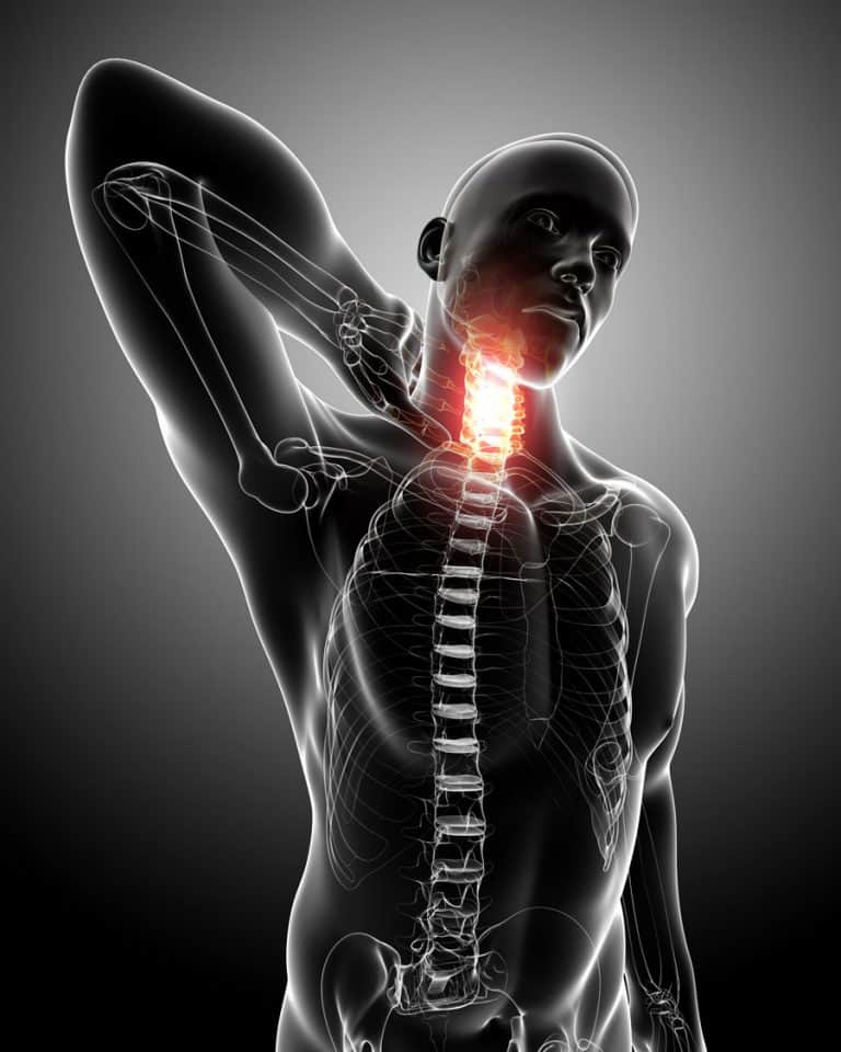 Managing Neck Pain | Pain & Spine Specialists